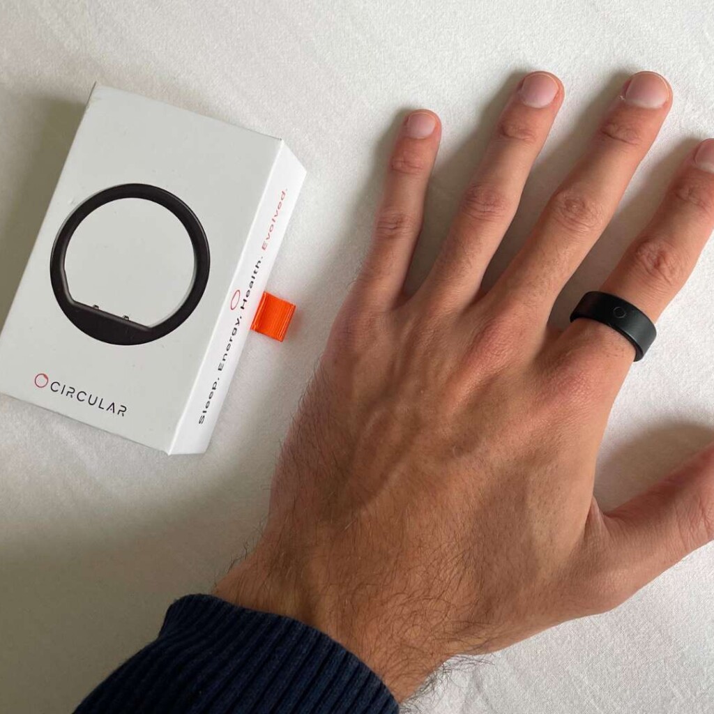 lipoprotein lipase (LPL)